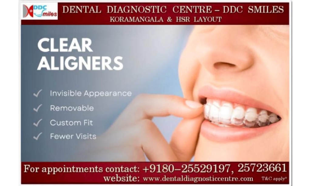 What Are Clear Aligners and How Do They Straighten Your Teeth?