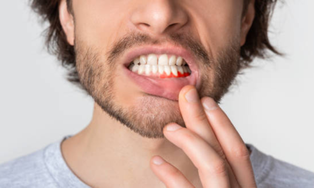 Signs and Symptoms of Endo-Perio Lesions You Shouldn’t Ignore